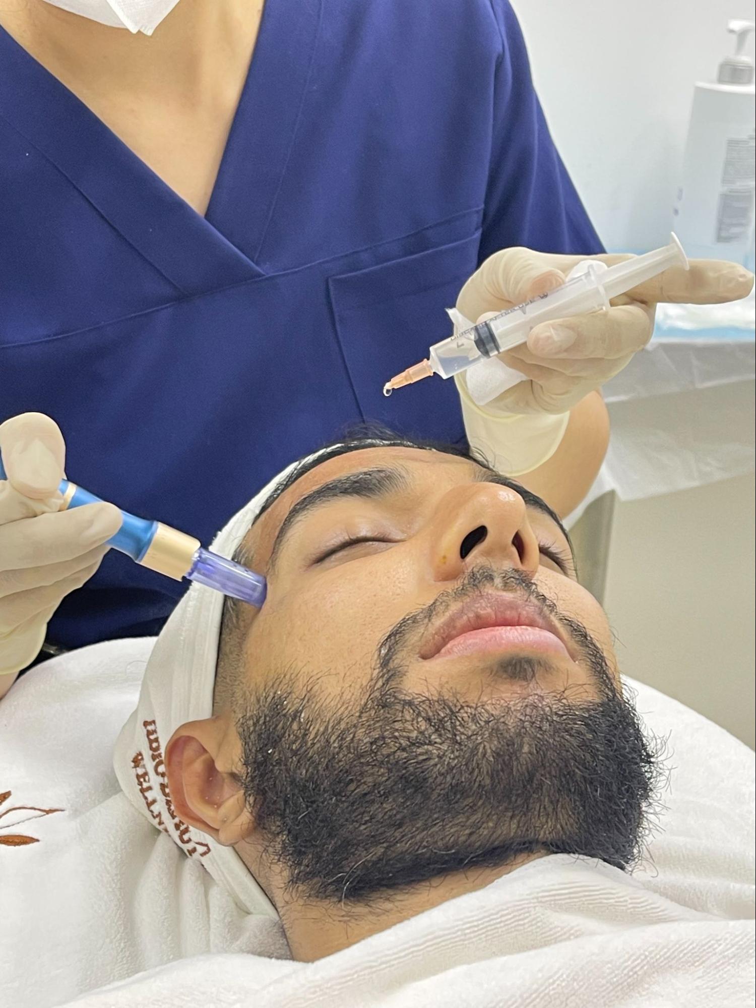 Công Nghệ Skin Pen – Giải Pháp Chuẩn FDA Giúp Tái Tạo Làn Da